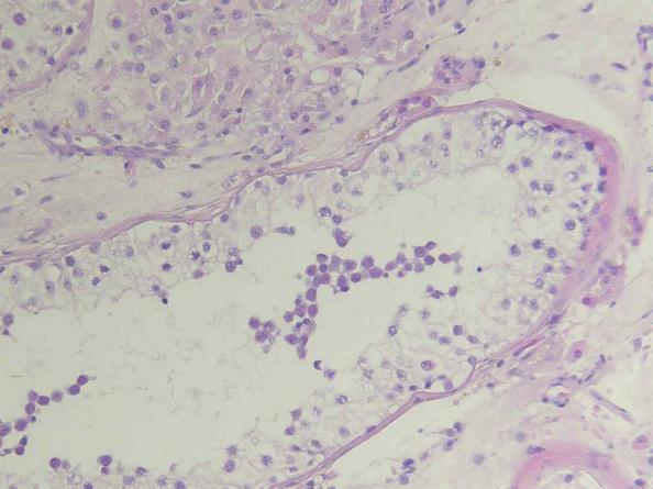 Histo Makro Pathologie Basic